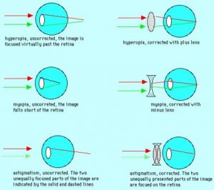 Refraction vs Diffraction - Examples, Differences, FAQs